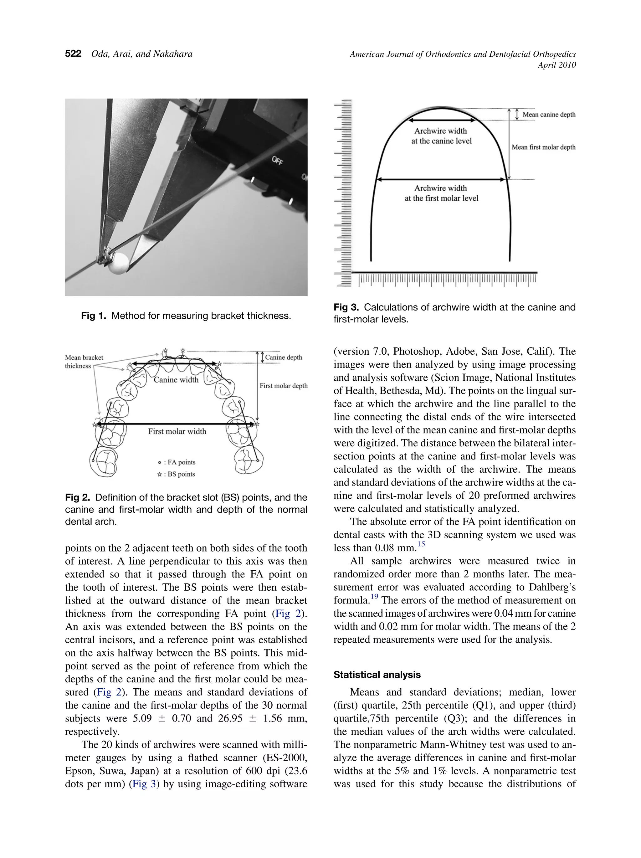 Commercially available archwire forms compared with normal dental arch ...