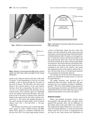 Commercially available archwire forms compared with normal dental arch ...
