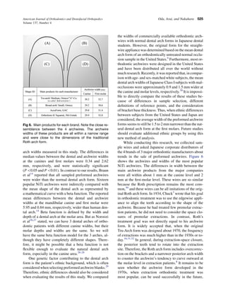 Commercially available archwire forms compared with normal dental arch ...