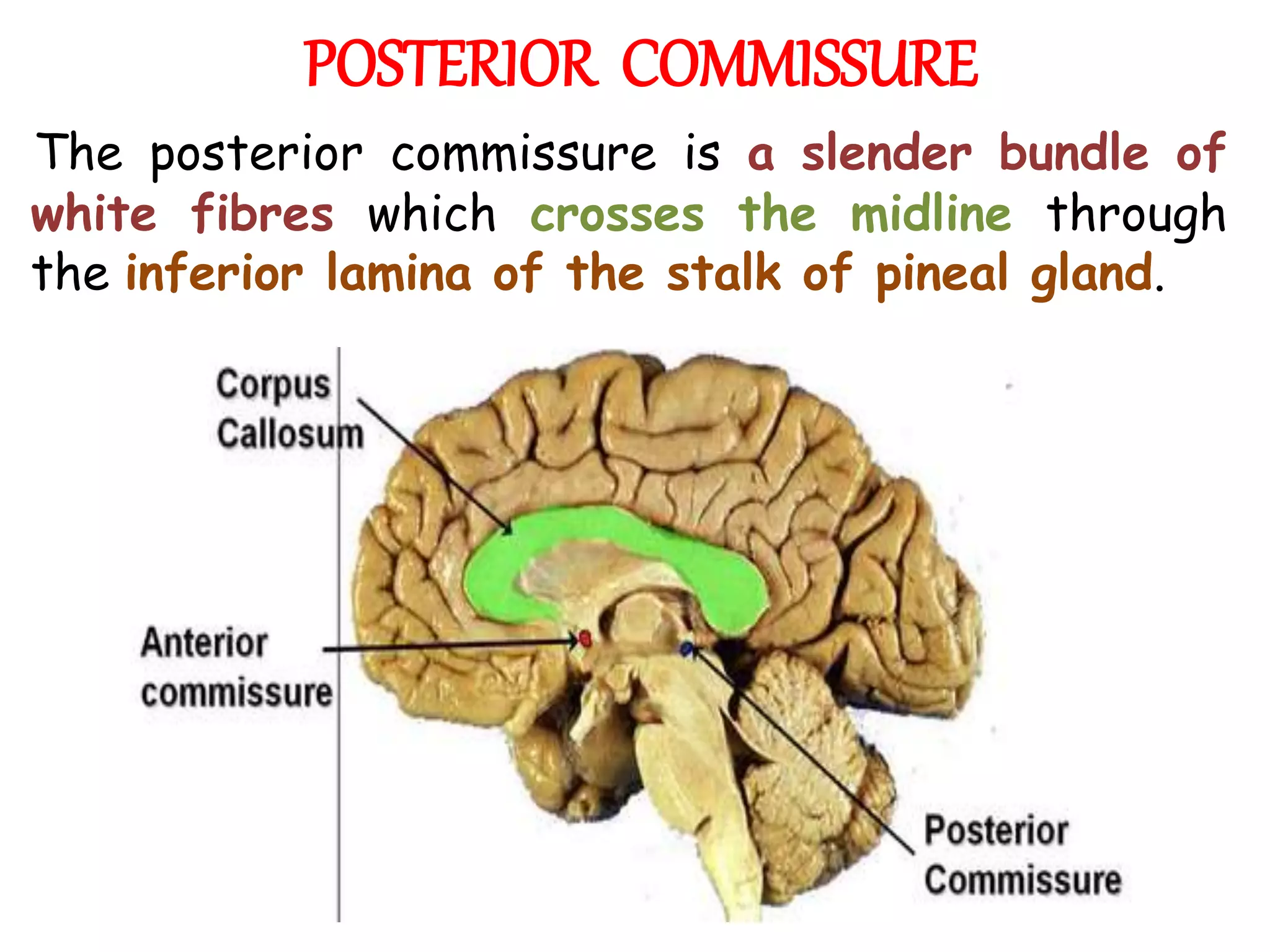 Commissural fibres | PPTX