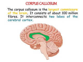 Commissural fibres | PPTX