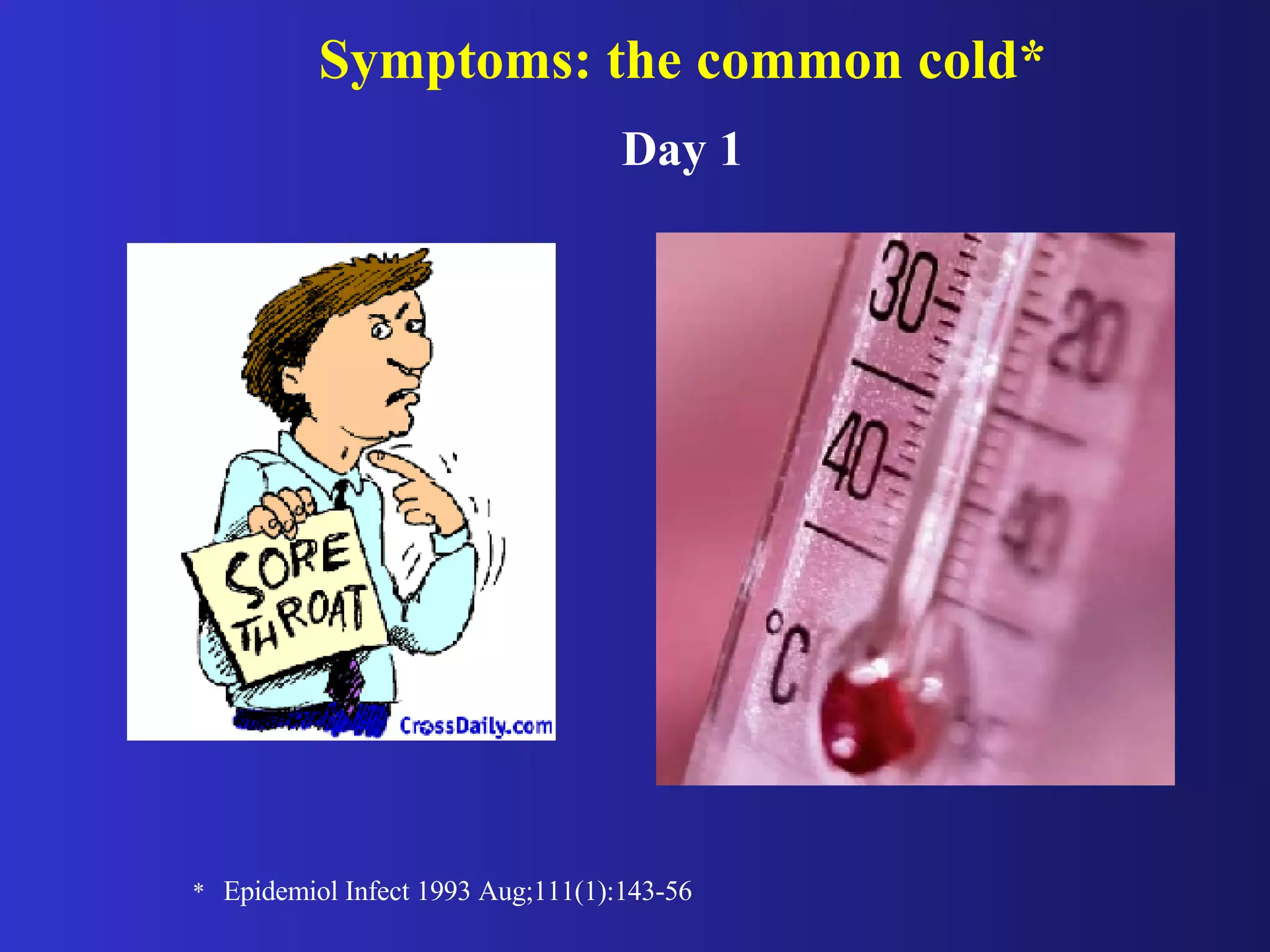 Common Cold | PPT