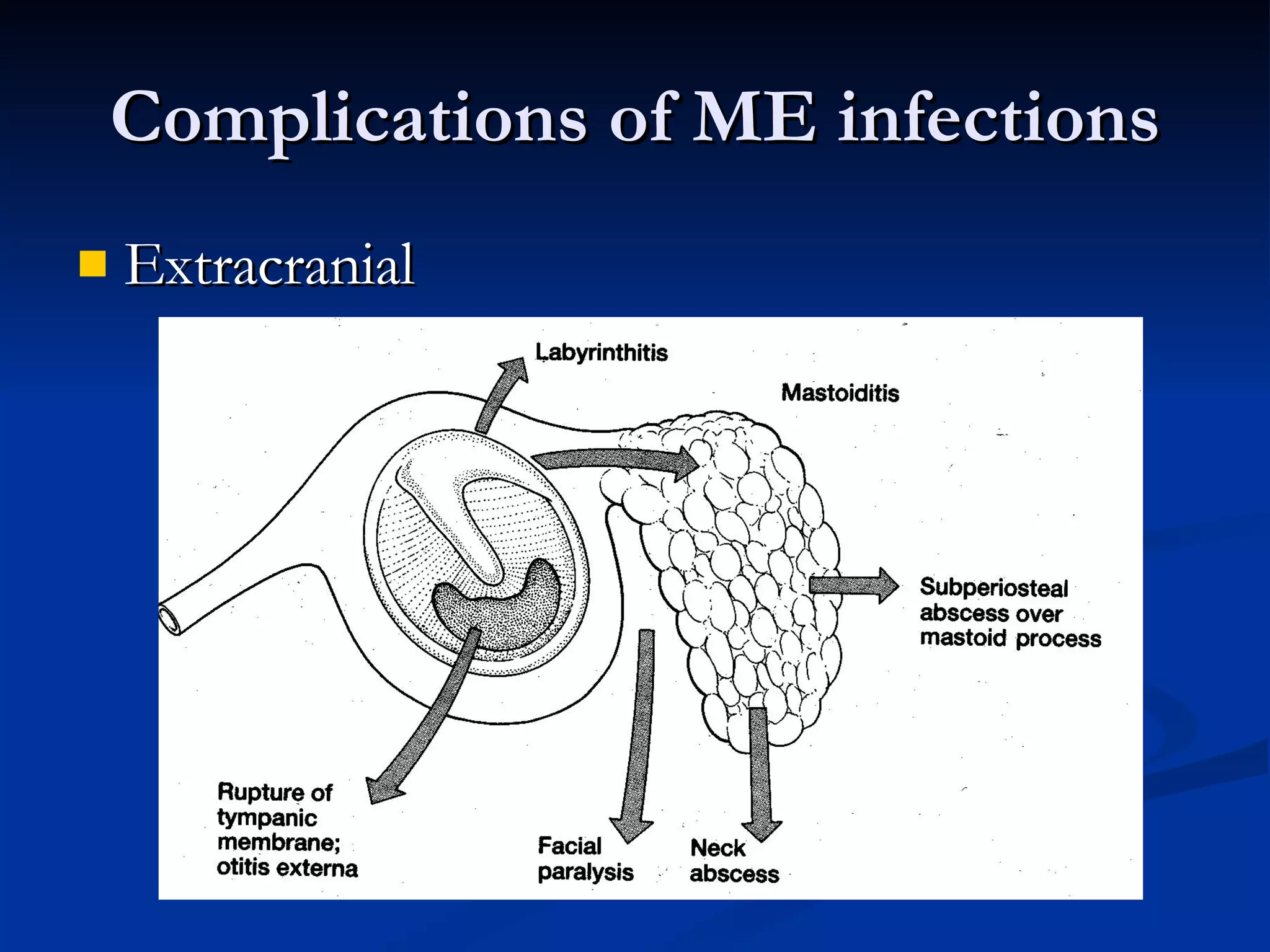 Common ENT emergencies | PPS