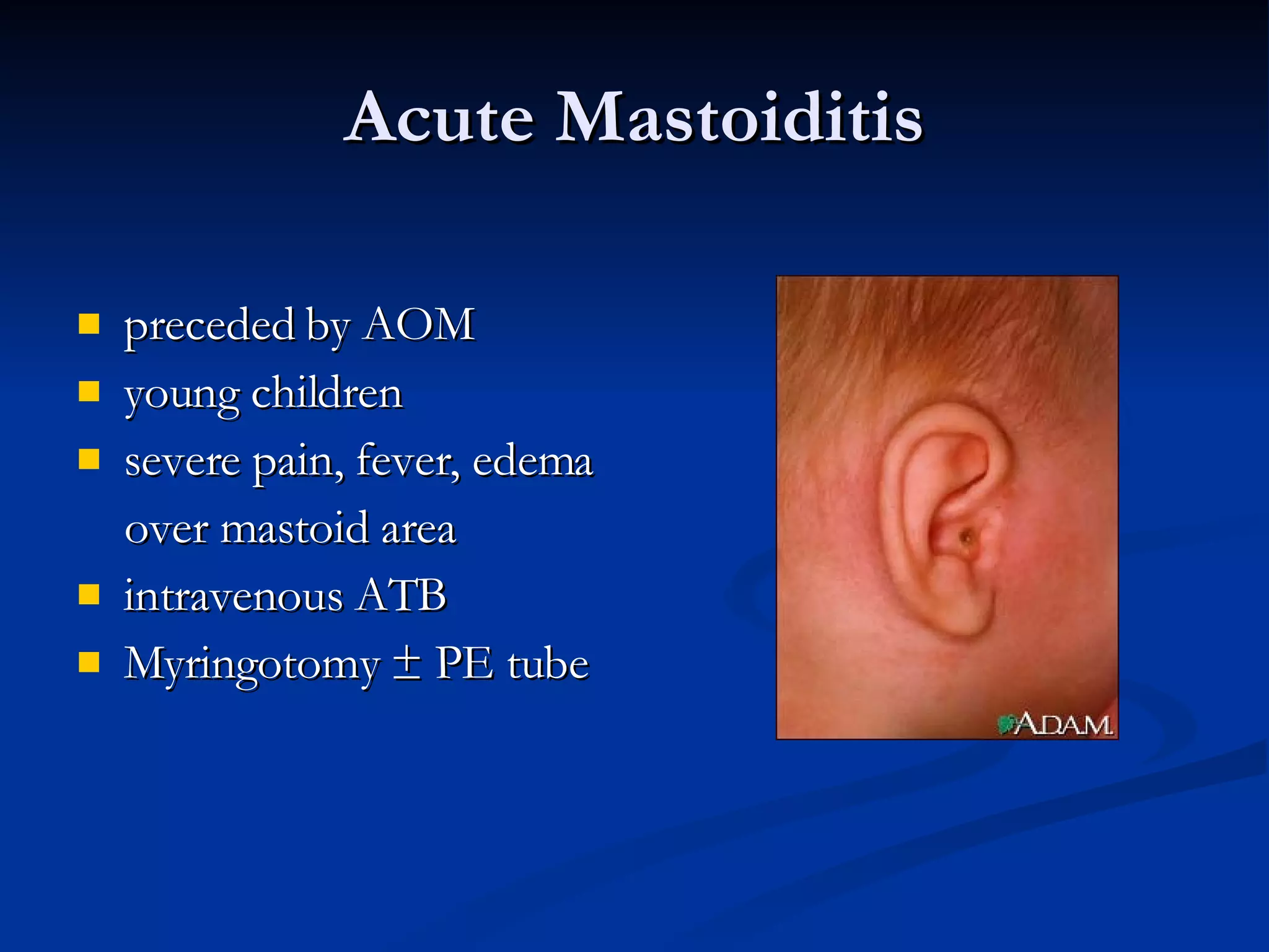 Common ENT emergencies | PPS