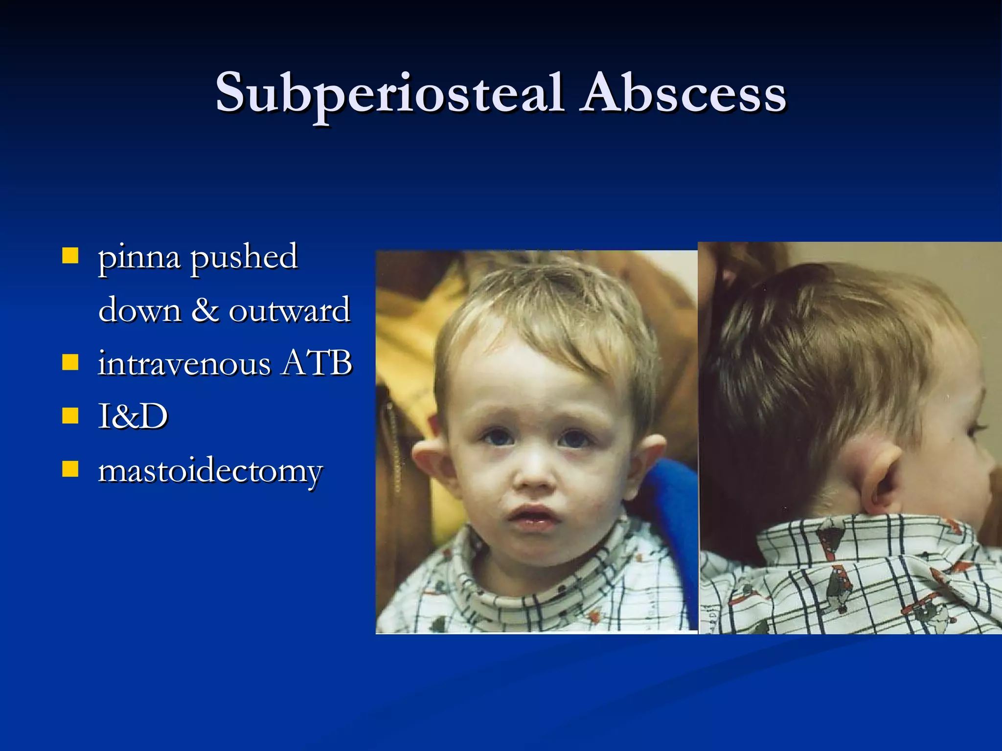 Common ENT emergencies | PPS