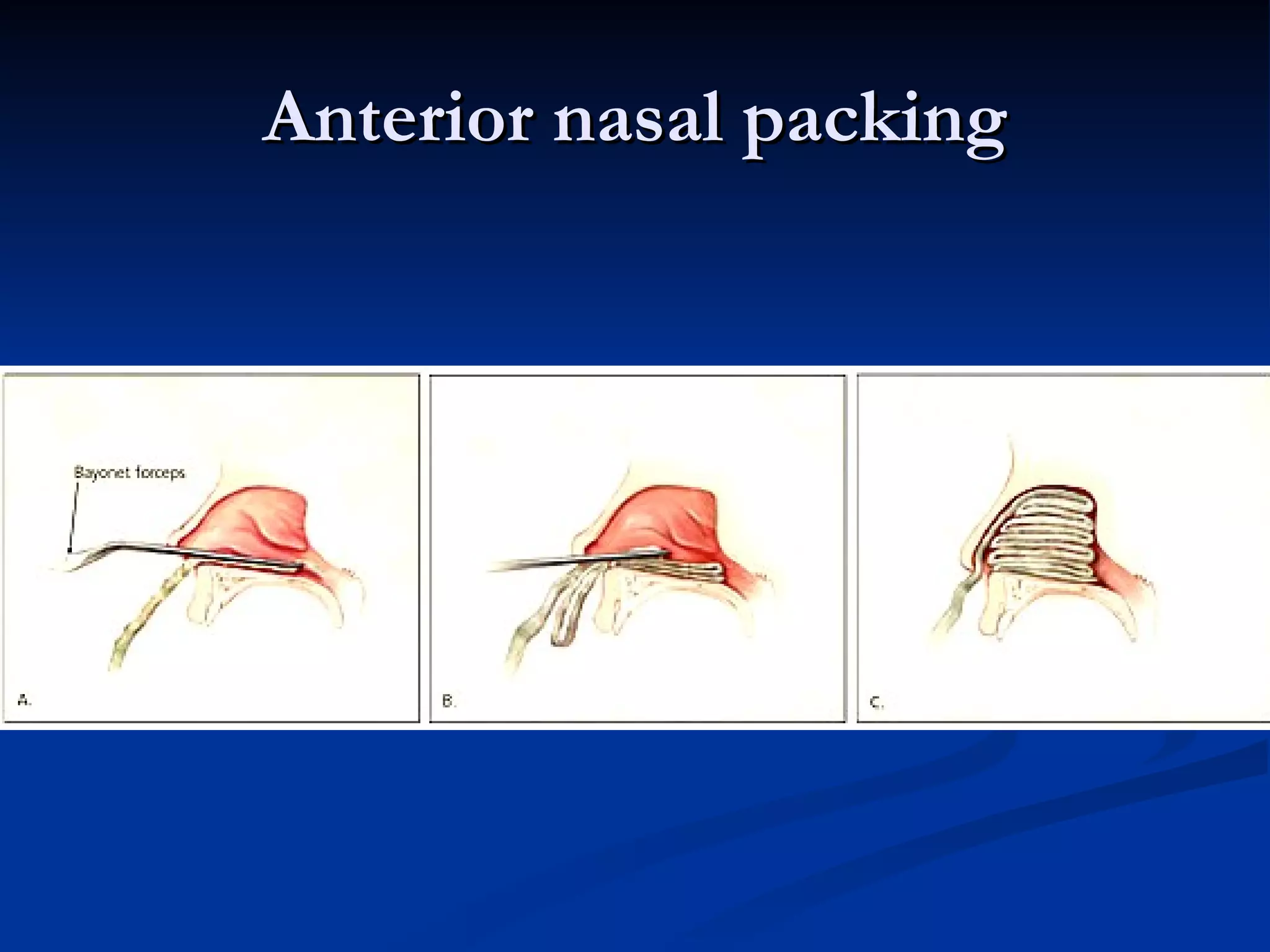 Common ENT emergencies | PPS