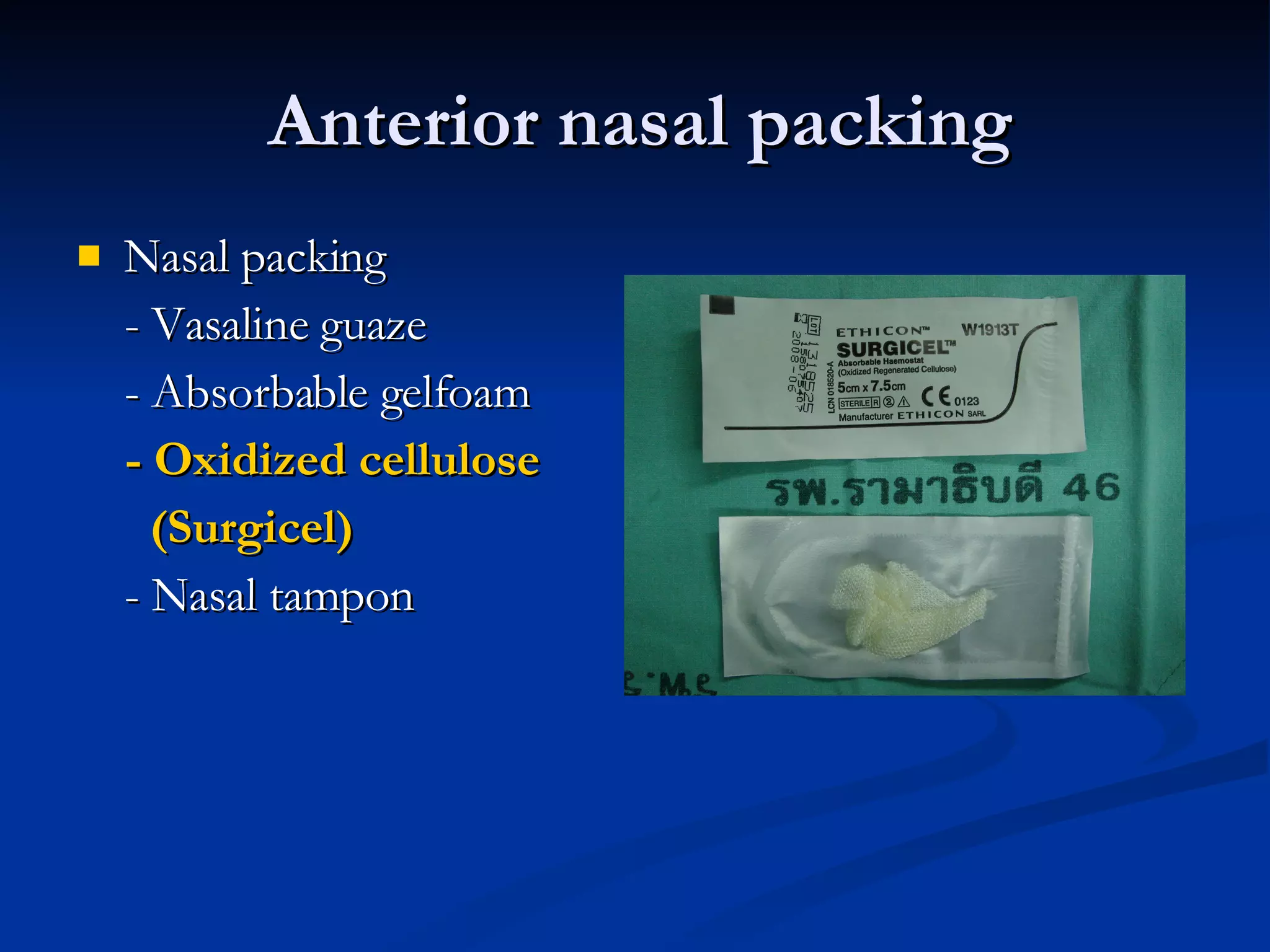 Common ENT emergencies | PPS