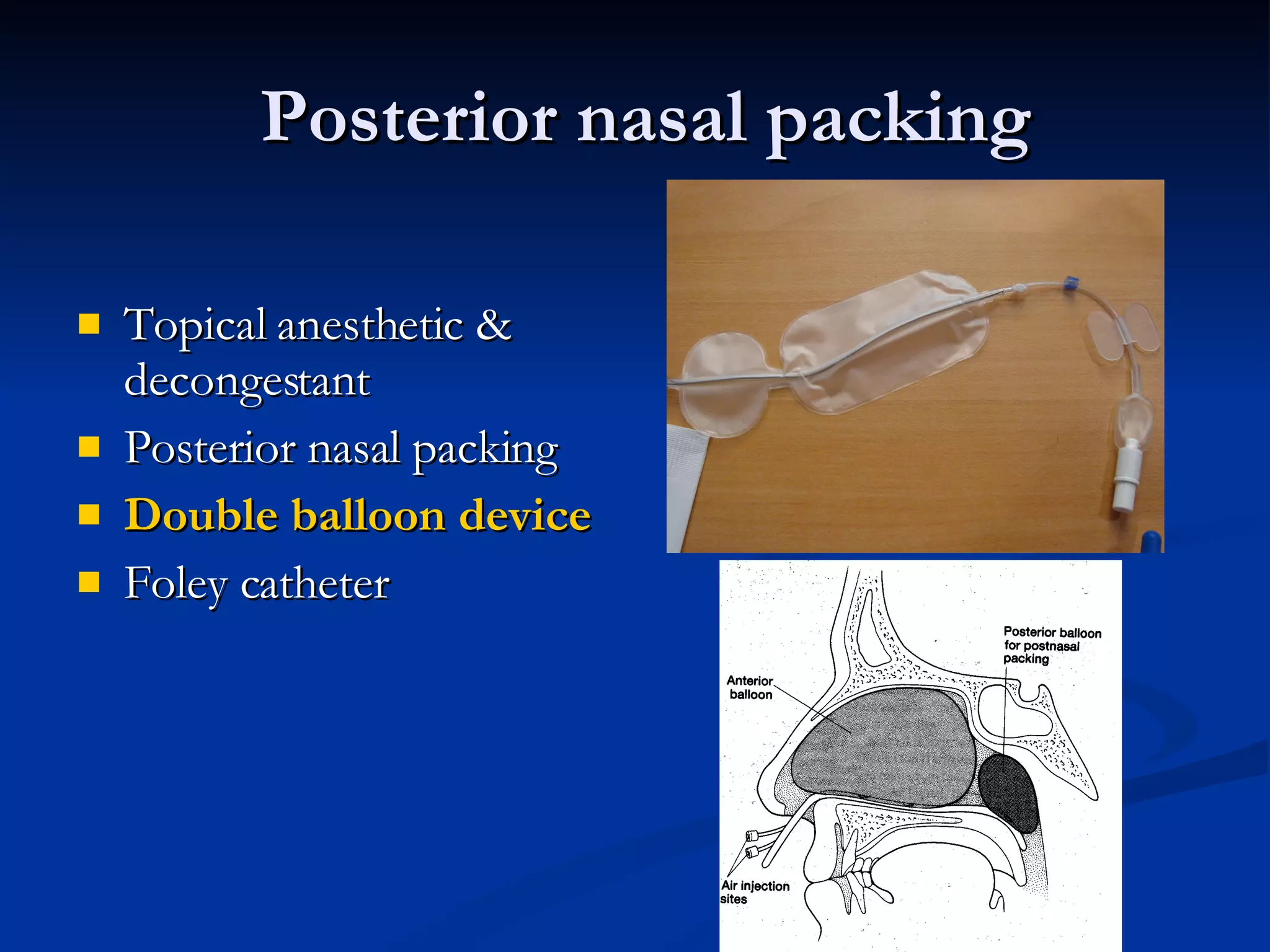 Common ENT emergencies | PPS