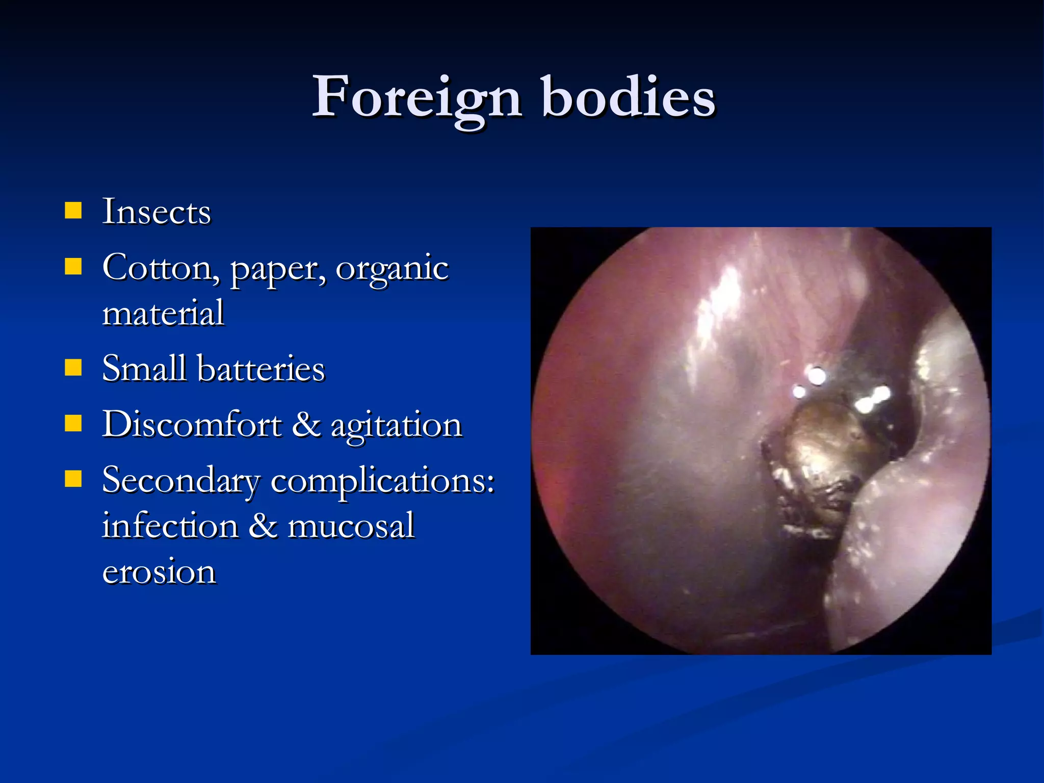 Common ENT emergencies | PPS