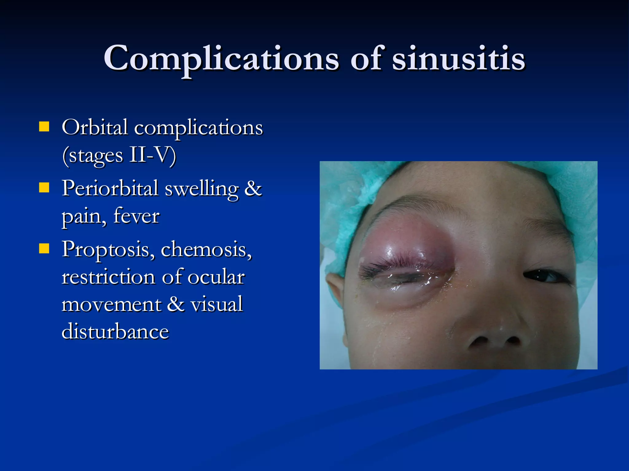 Common ENT emergencies | PPS