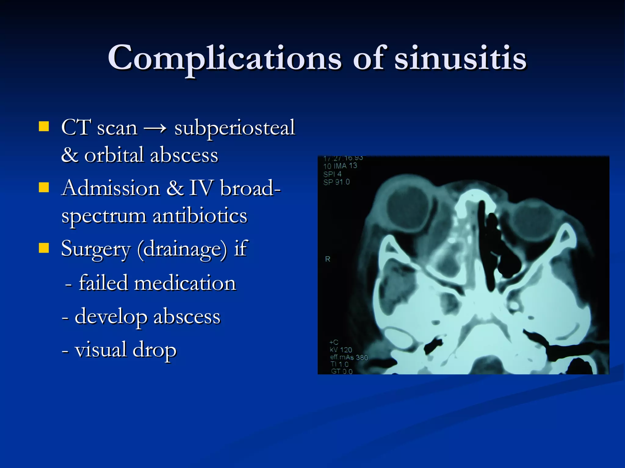 Common ENT emergencies | PPS