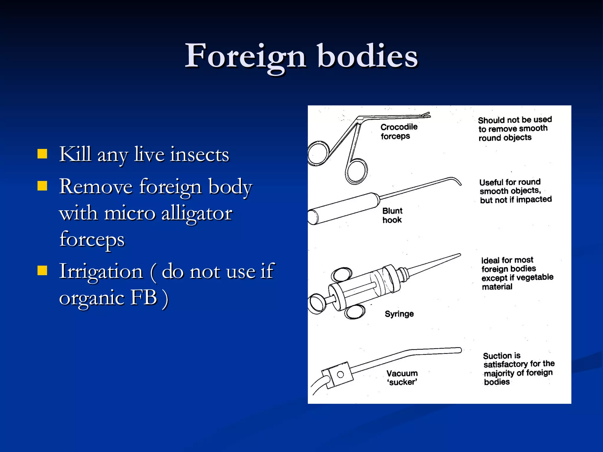 Common ENT emergencies | PPS