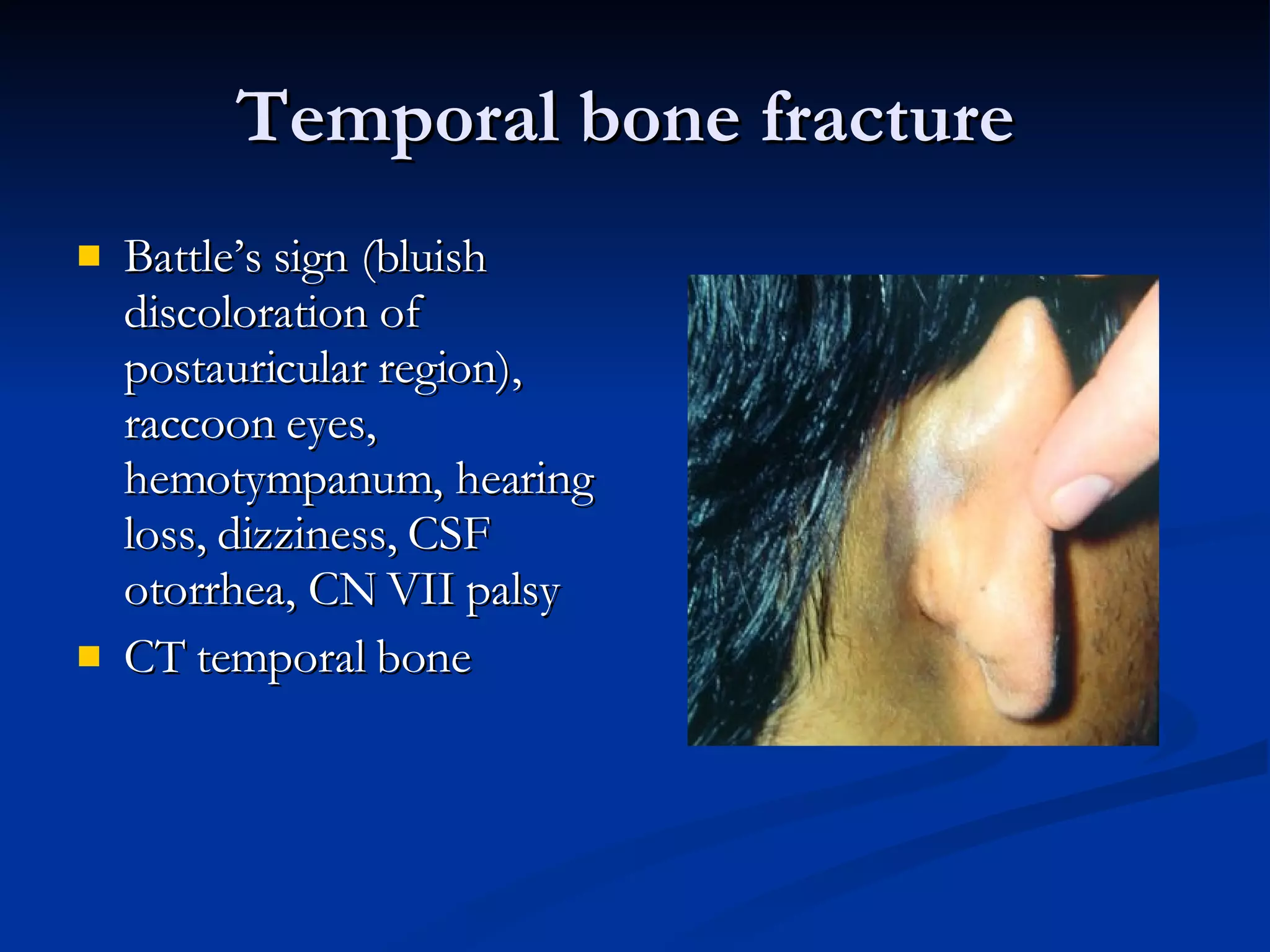 Common ENT emergencies | PPS