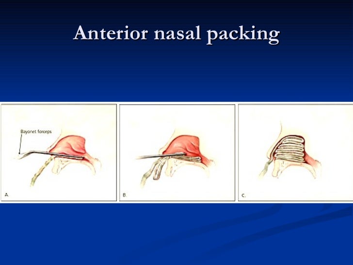 Common ENT emergencies