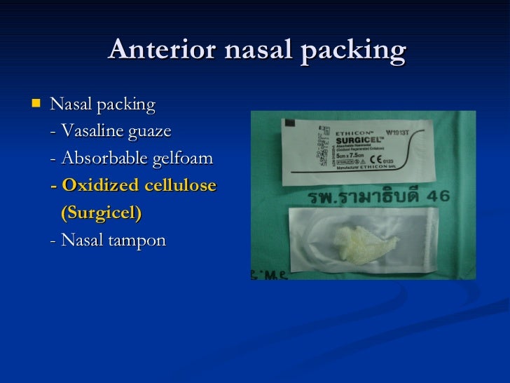 Common ENT emergencies