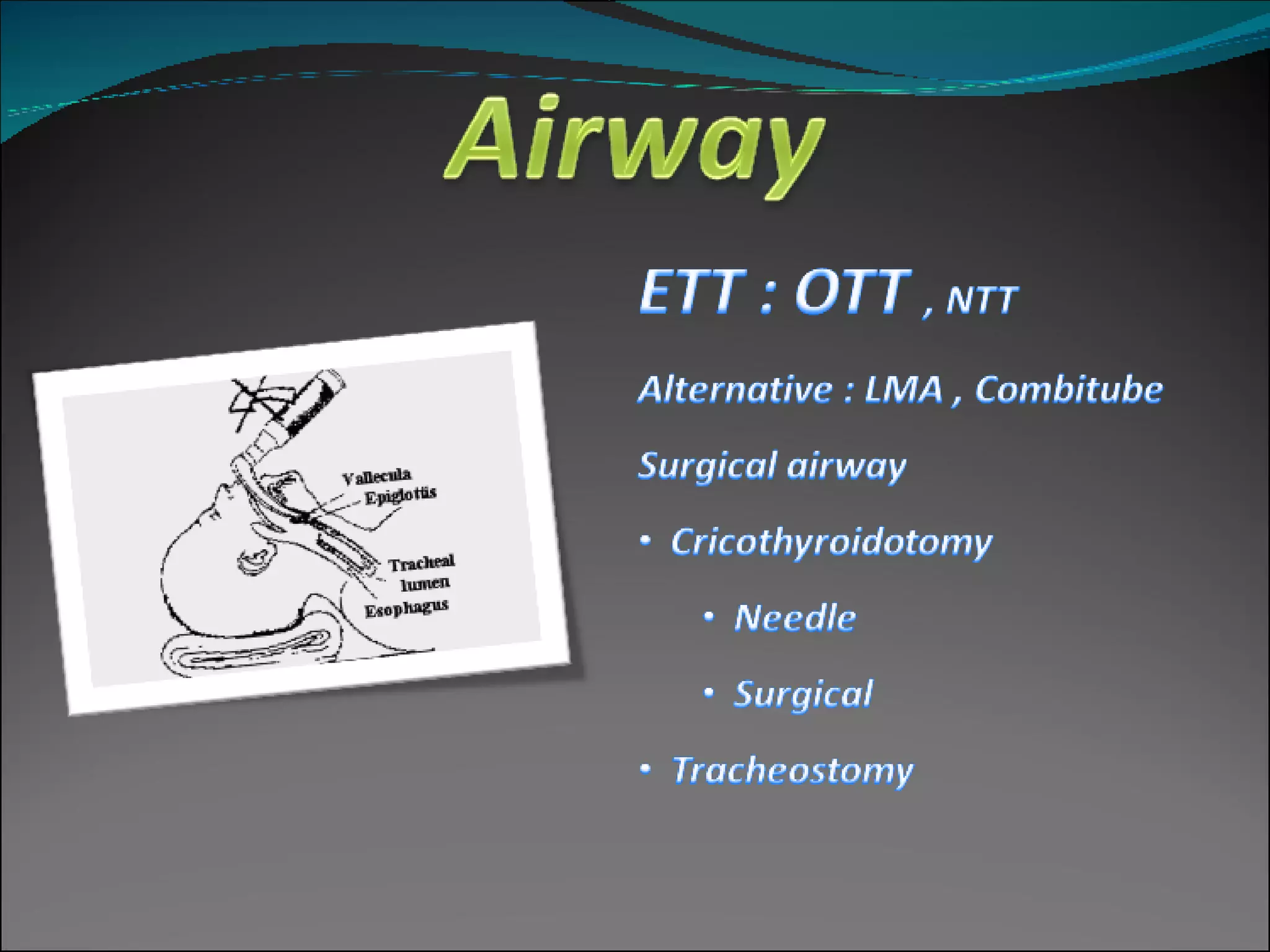 Common pitfalls in ER Procedure | PPT