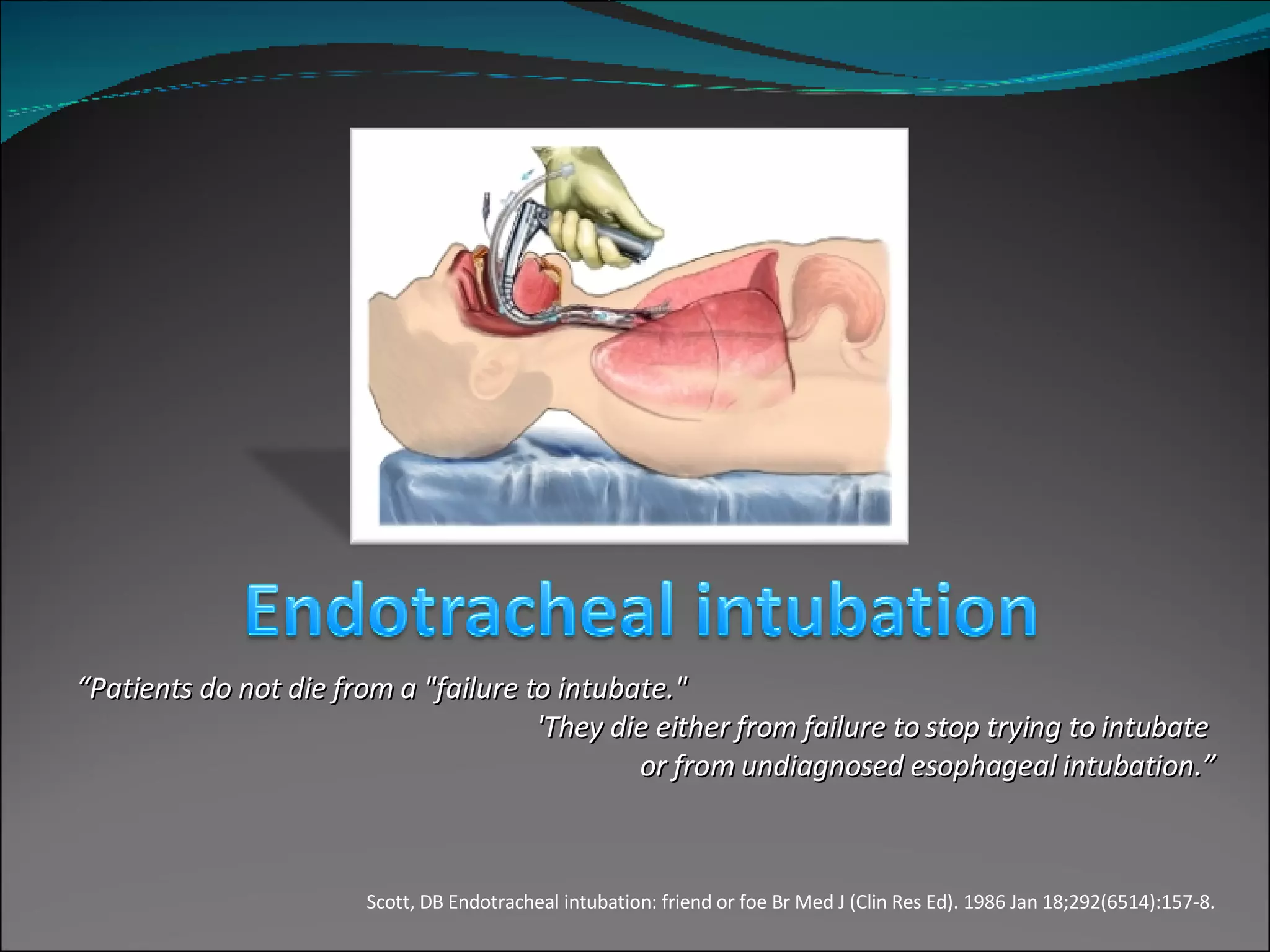 Common pitfalls in ER Procedure | PPT