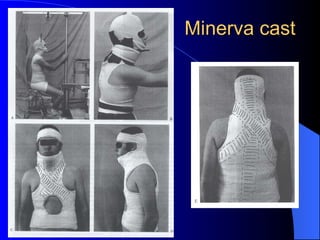 Minerva Cast