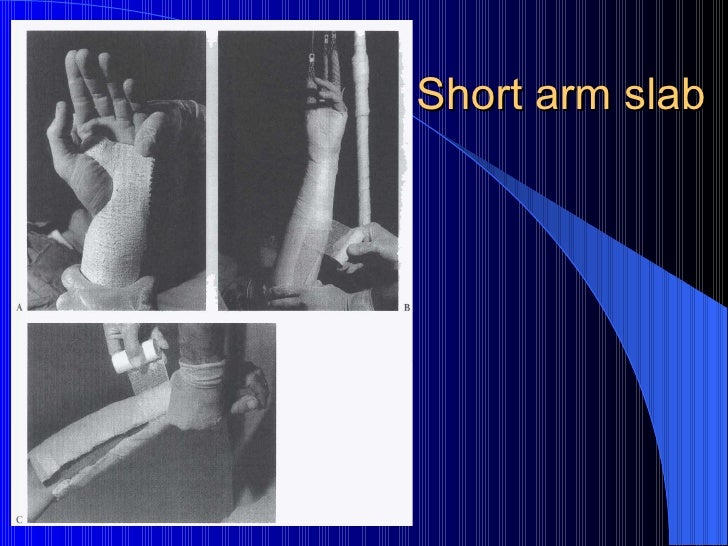 Common Pitfalls In Orthopedics