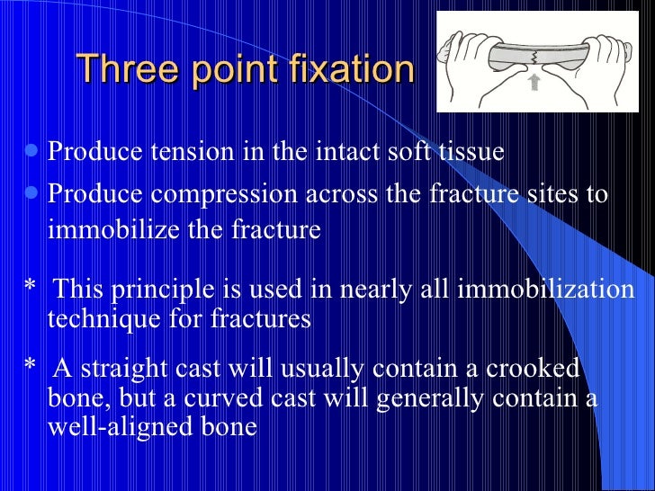 What Is Your Fixation Point at Georgia Farber blog