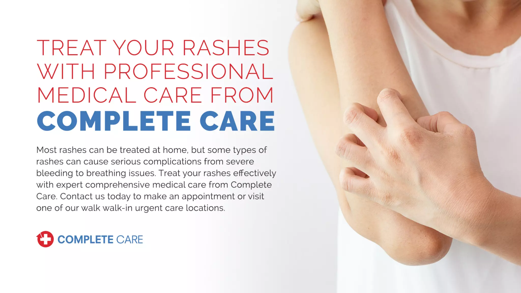 Types of Common Skin Rashes | PDF | Skin and Dermatology | Diseases and ...