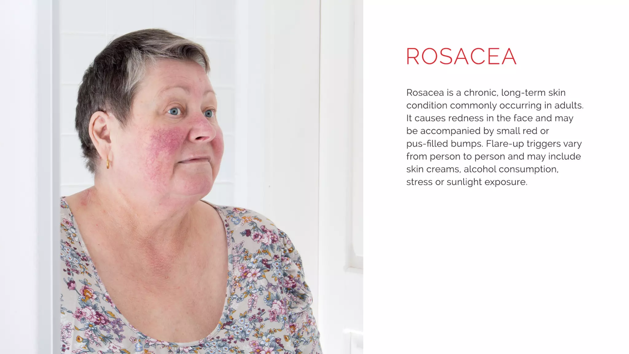 Types of Common Skin Rashes | PDF | Skin and Dermatology | Diseases and ...