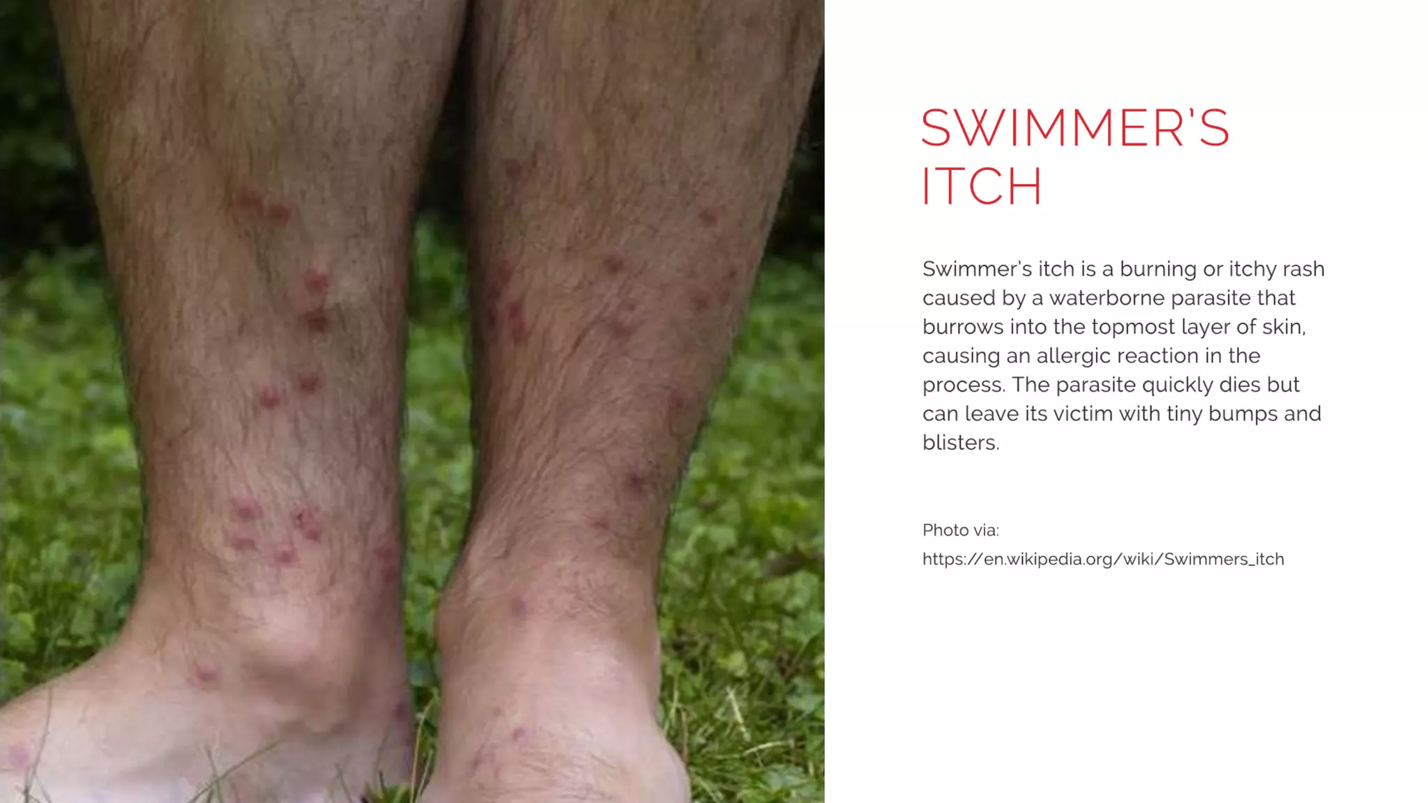 Types of Common Skin Rashes | PDF | Skin and Dermatology | Diseases and ...