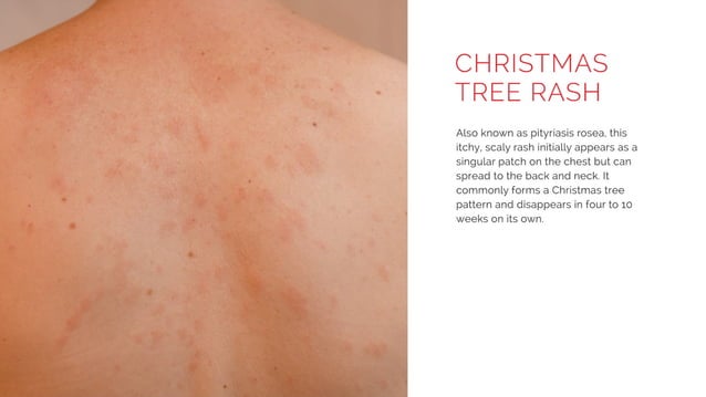 Types of Common Skin Rashes | PDF