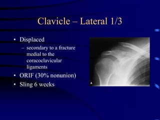 Common Upper Limb Fractures | PPSX