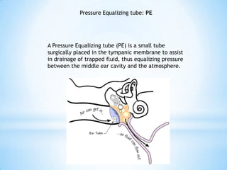 Common abbreviations for eyes and ears | PPTX