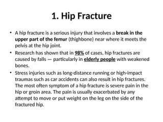 COMMON ACUTE AND OVERUSE INJURIES OF HIP JOINT.pptx