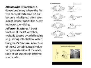 Common acute and overuse injuries of spine.pptx