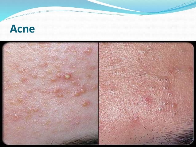 Common adult skin conditions