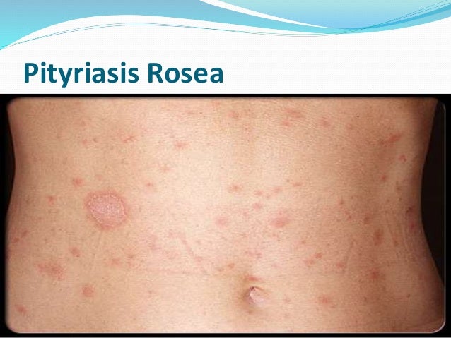 Common adult skin conditions