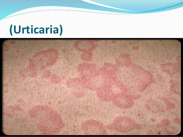 Common adult skin conditions