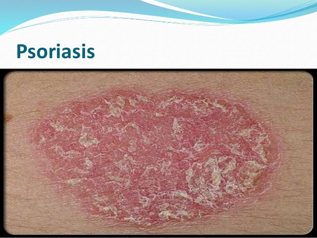 Common adult skin conditions