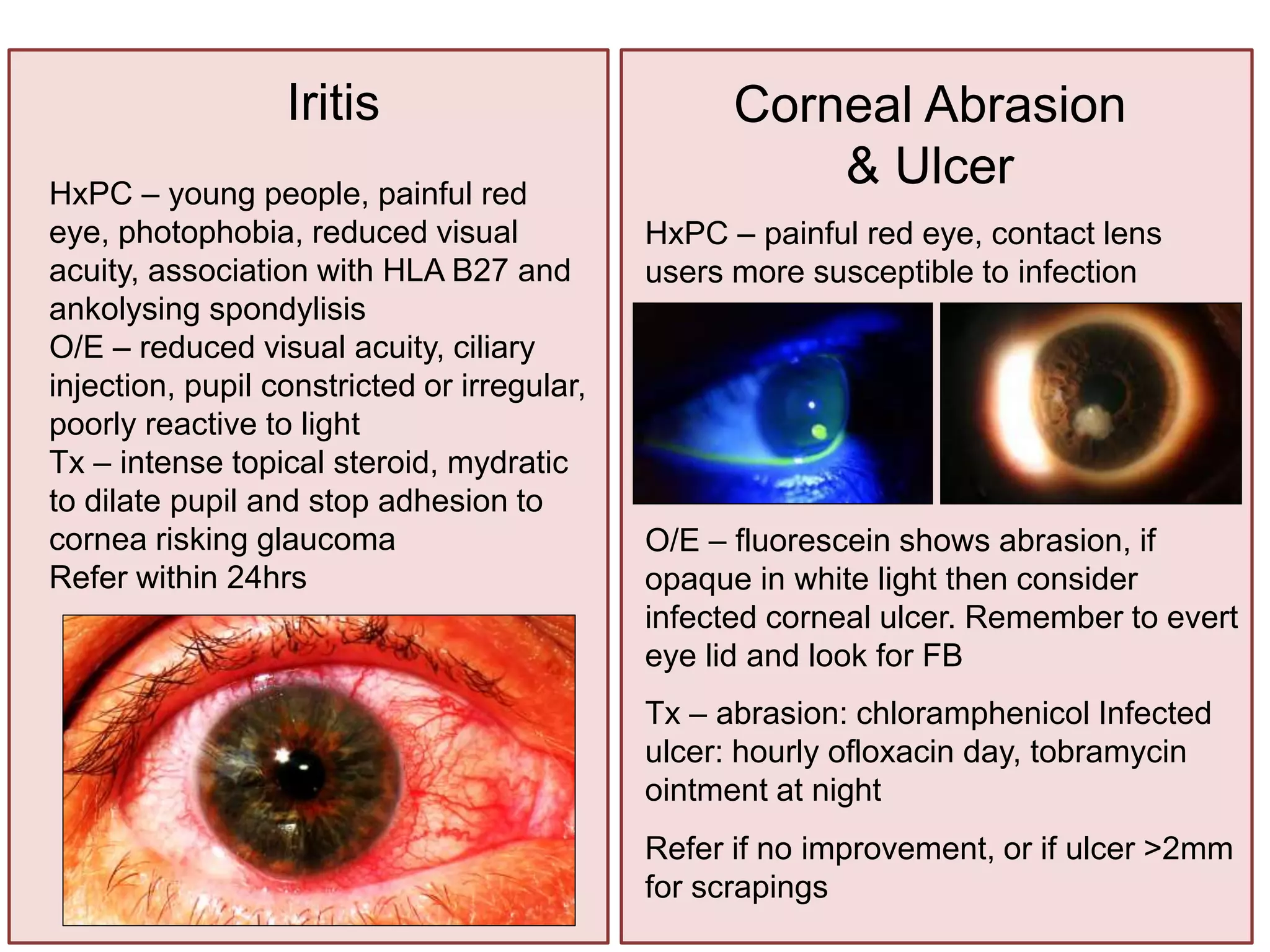 Eye presentations to the Emergency Department | PPTX