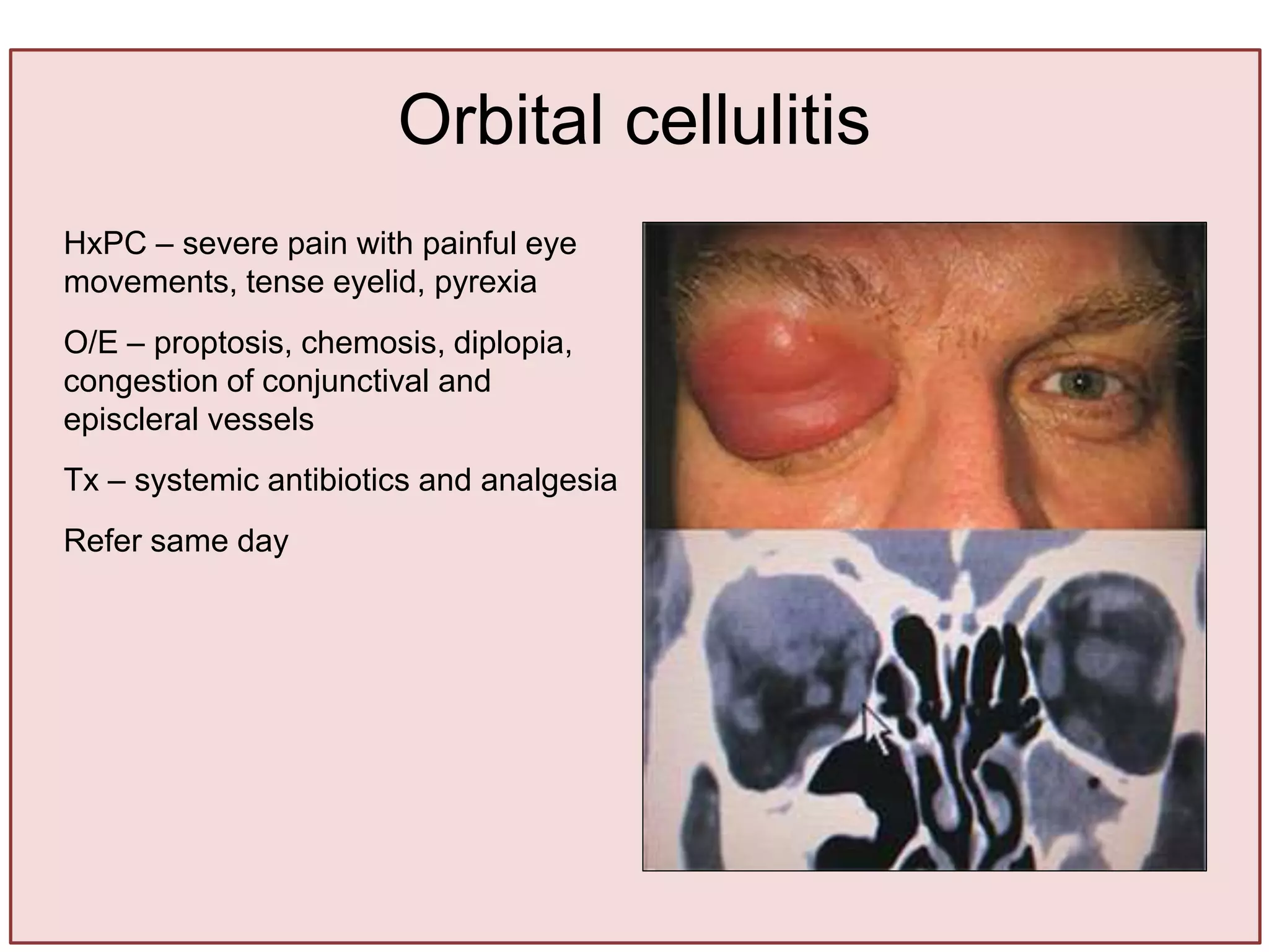 Eye presentations to the Emergency Department | PPTX