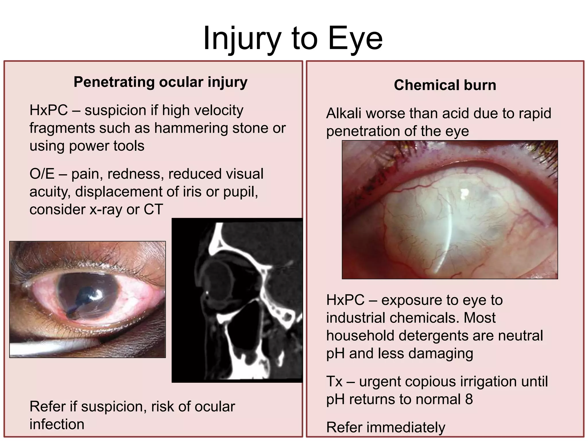 Eye presentations to the Emergency Department | PPTX