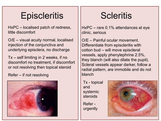 Eye presentations to the Emergency Department | PPTX