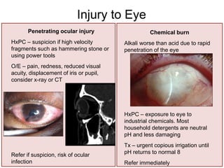 Eye presentations to the Emergency Department | PPTX