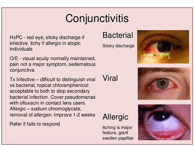 Eye presentations to the Emergency Department