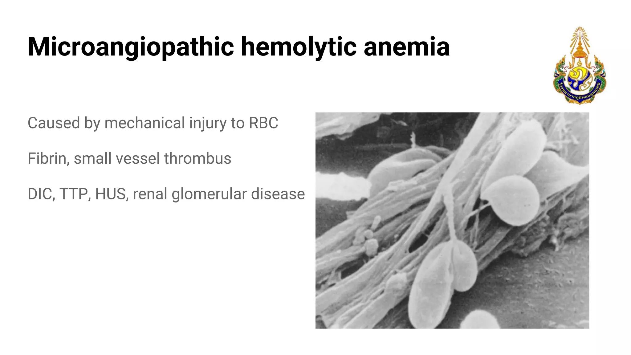 Common anemia | PDF