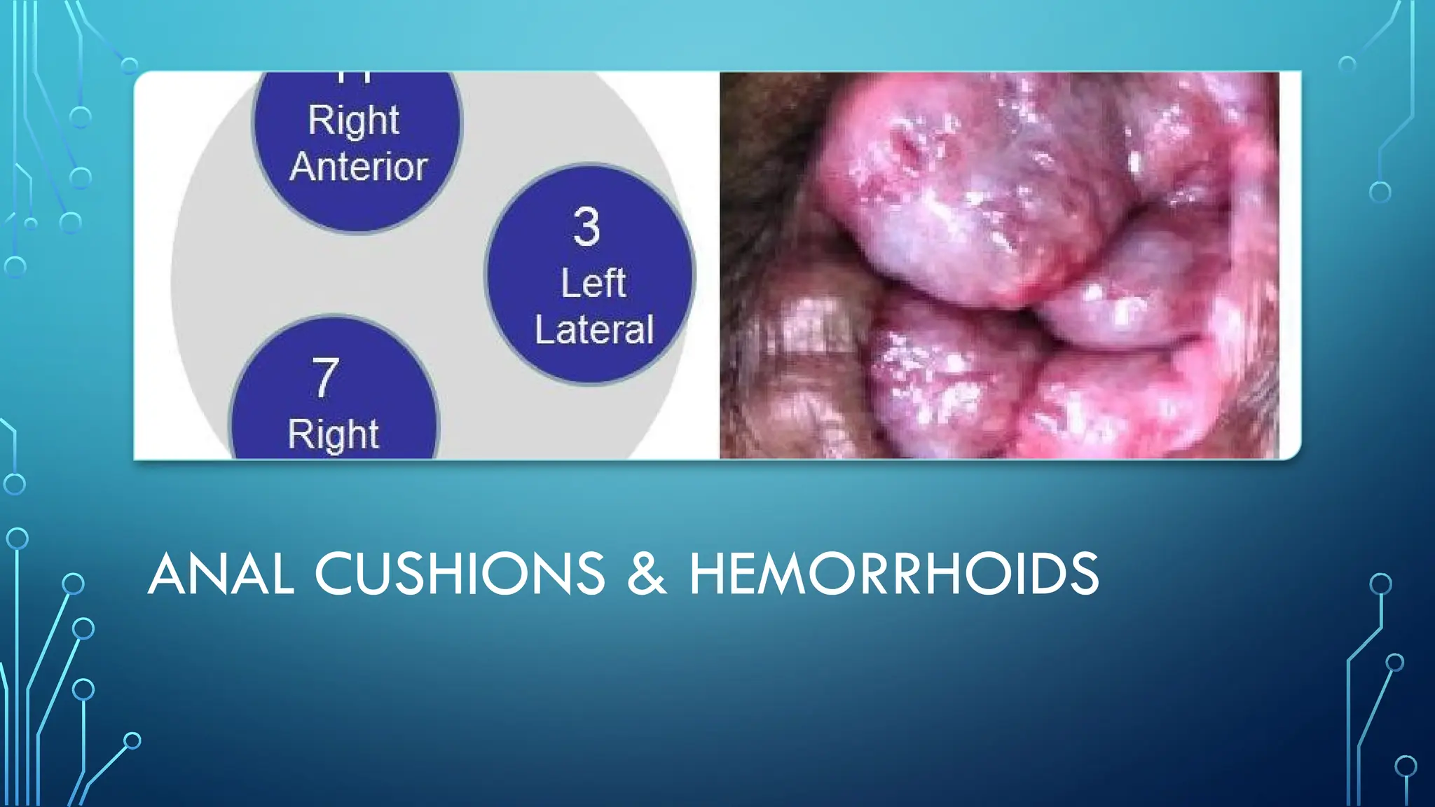 common anorectal diseases (hemorrhoids, anal fissure, rectal prolapse, anal suppration, and ...