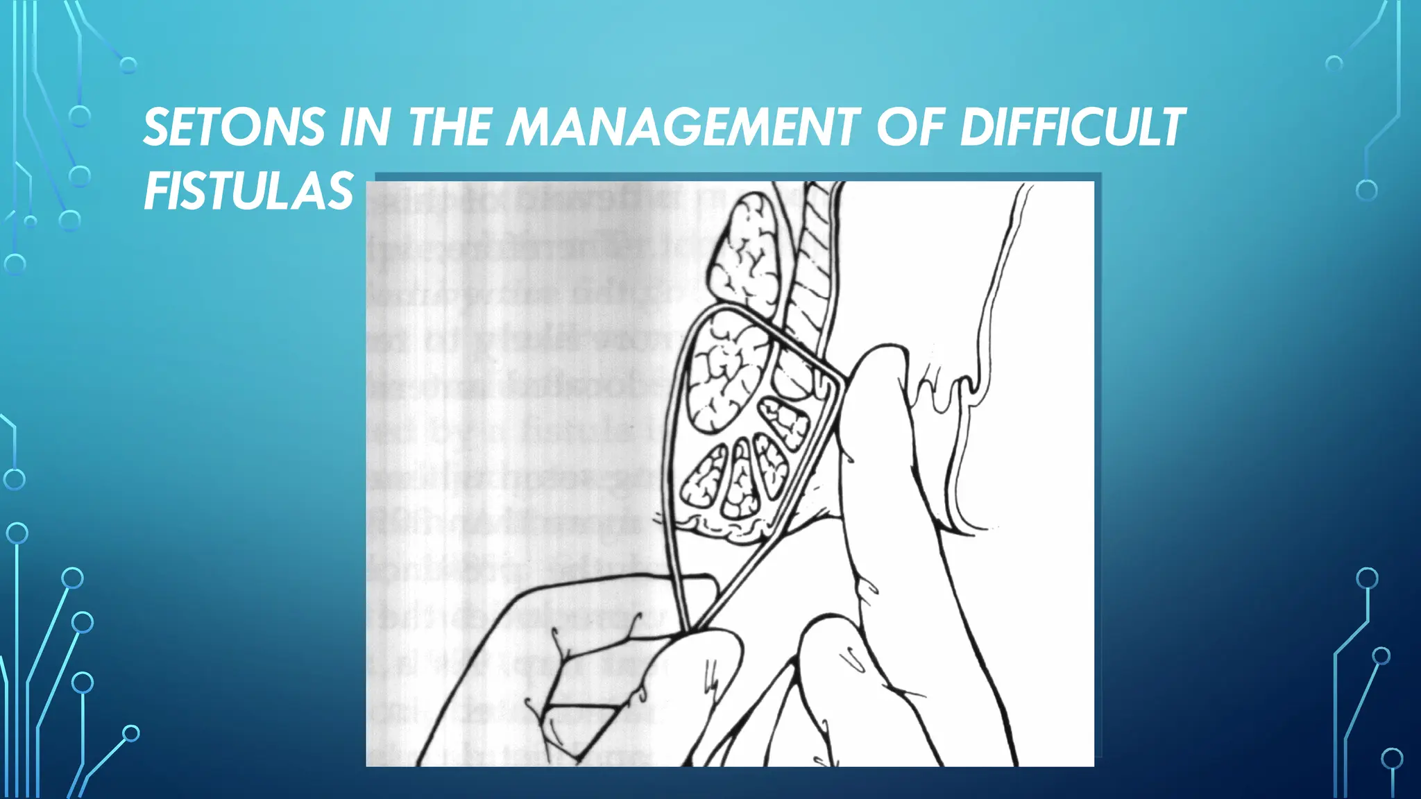 common anorectal diseases (hemorrhoids, anal fissure, rectal prolapse ...