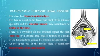 common anorectal diseases (hemorrhoids, anal fissure, rectal prolapse ...
