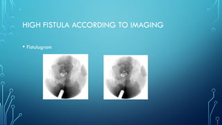common anorectal diseases (hemorrhoids, anal fissure, rectal prolapse ...
