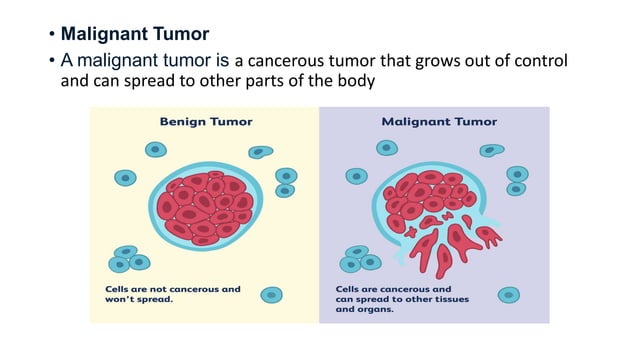 Common benign tumor and malignant tumor.pdf