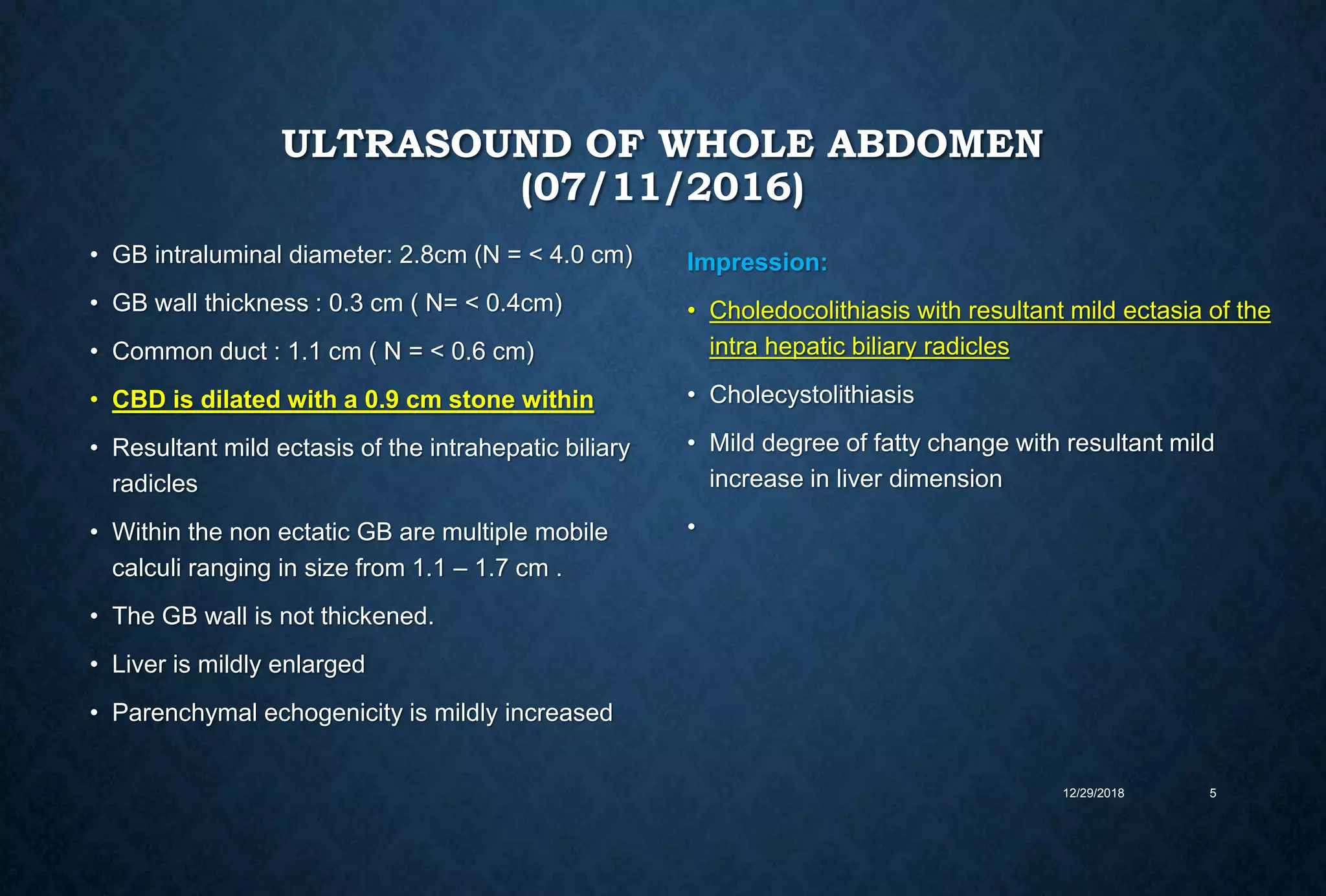 Common bile duct stone | PPT