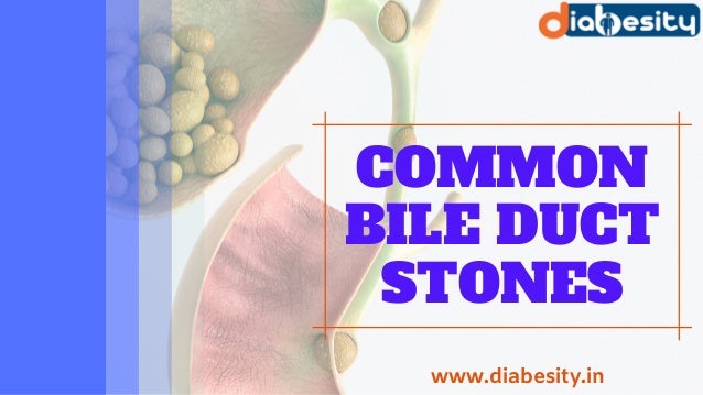 All About Common Bile Duct Stones